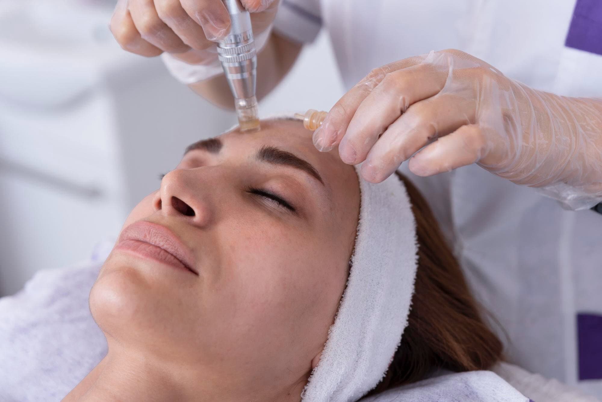 Skin Needling with Exosome Treatment – Elements Aesthetics Co